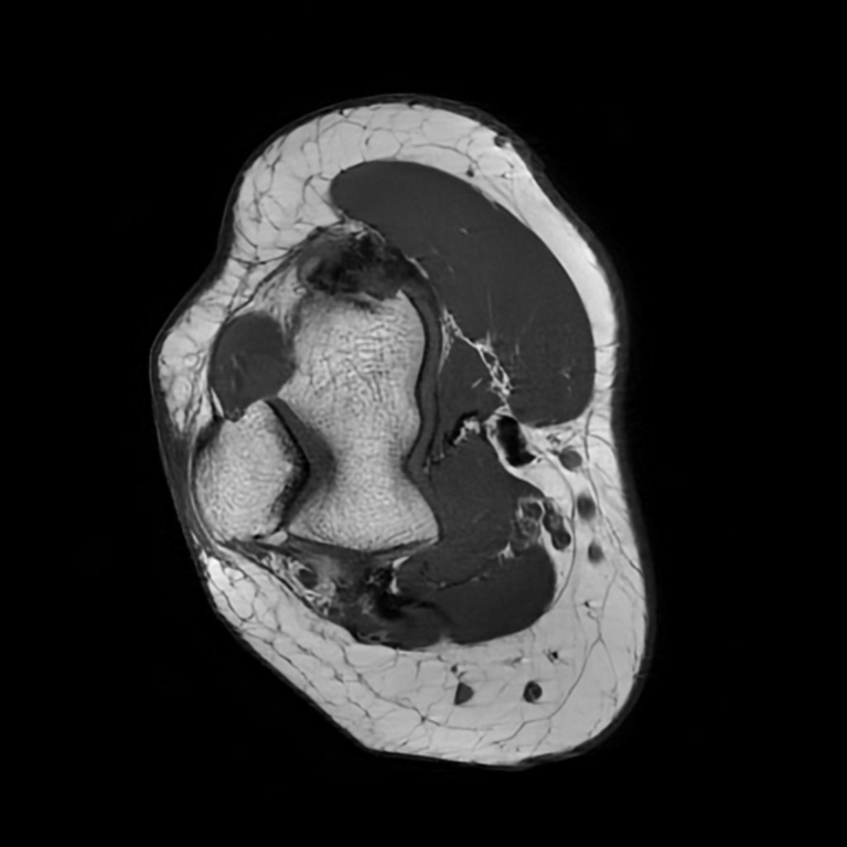 GE X CMRAD Landing Page - Collective Minds Radiology